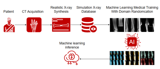 微美全息（NASDAQ:WIMI）开发Auto-AIX框架，采用医学全息合成X射线图像训练AI诊断模型_财富号_东方财富网
