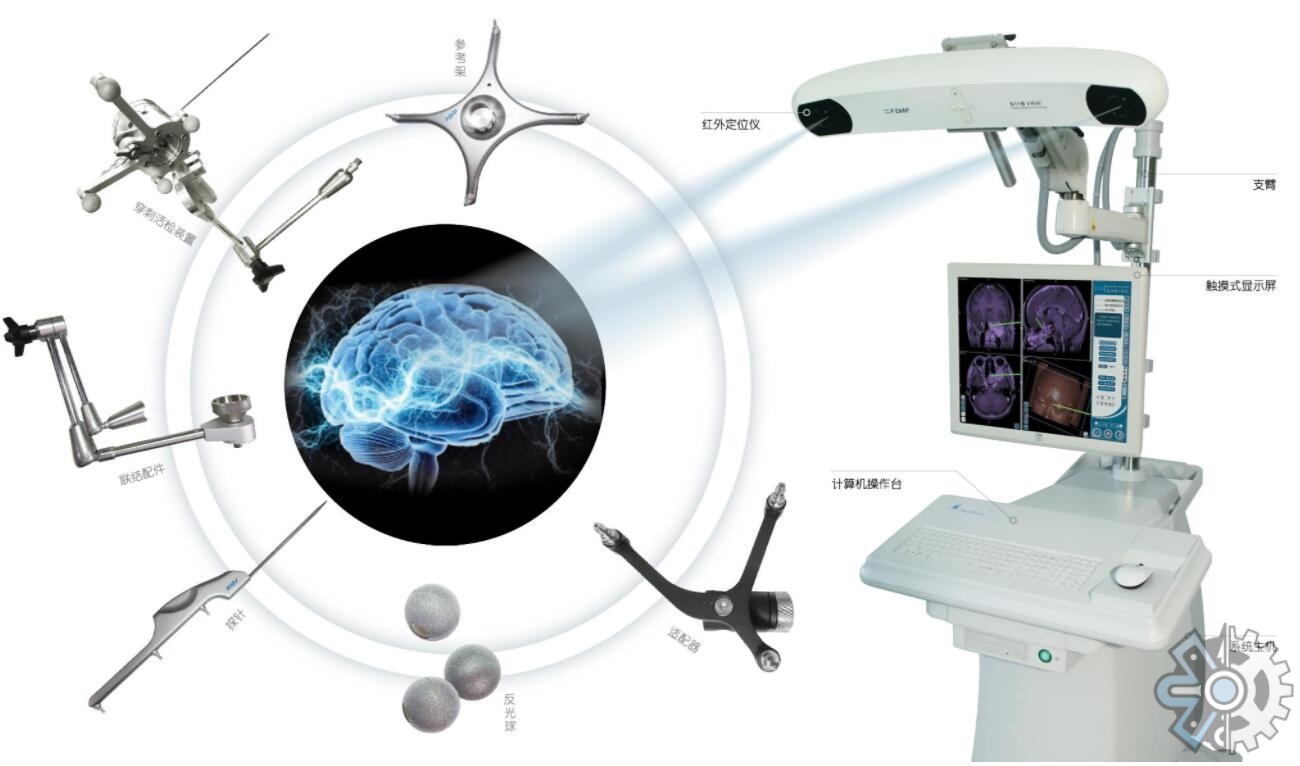 手术导航系统行业数据：2021年全球手术导航系统收入大约1188百万美元_财富号_东方财富网