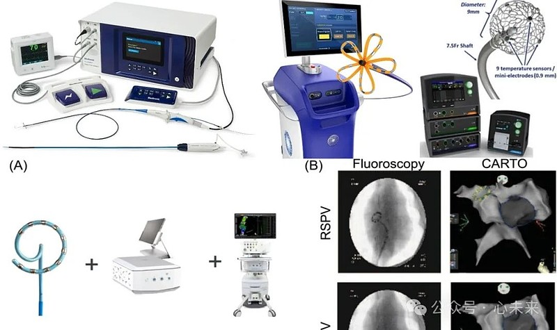 首批人体实验！雅培进军脉冲电场消融_财富号_东方财富网